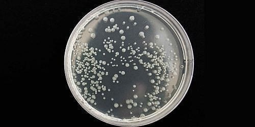 Endotoxin Testing and Its Importance: Ensuring Product Quality and ...